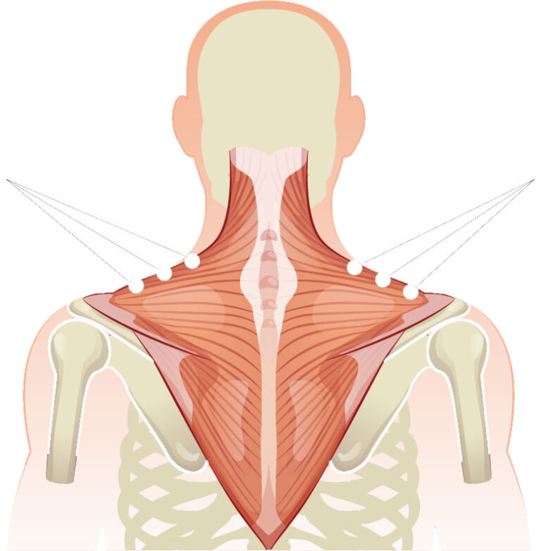 Trapezius / Traptox | AS Allure Aesthetics, Gloucester Rd / South ...